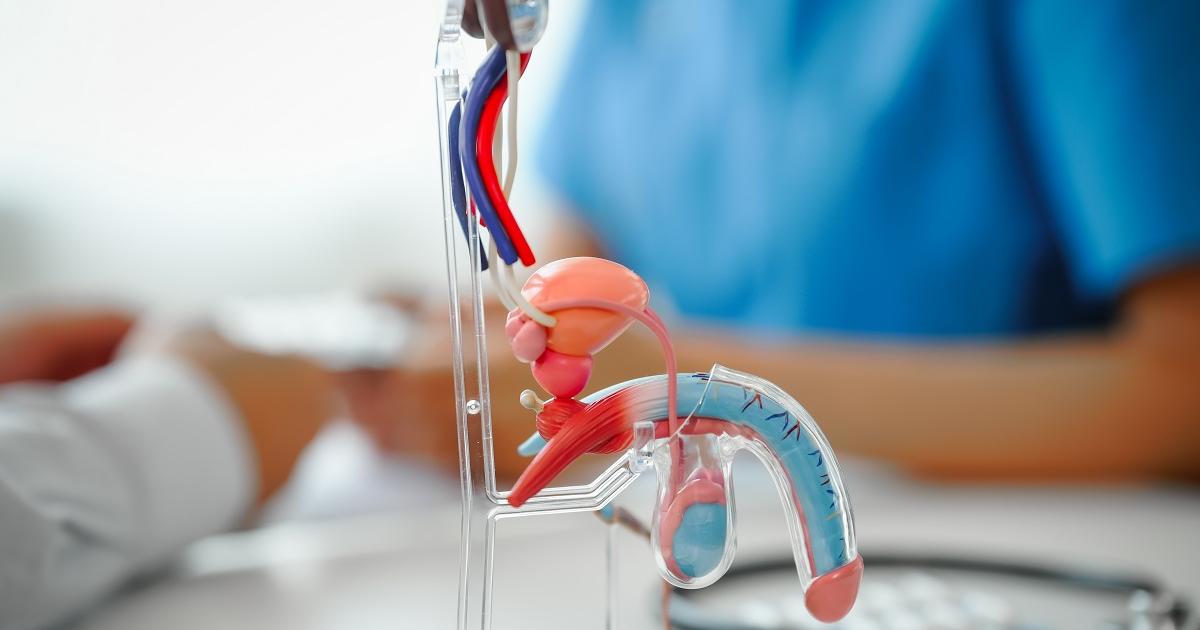 Chirurgia robotyczna w leczeniu raka prostaty: czym jest radykalna ...